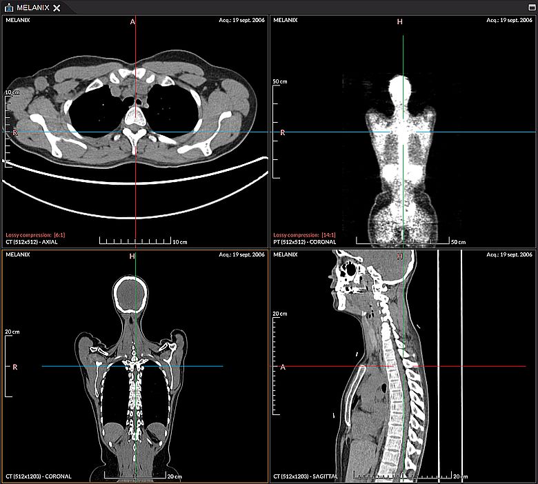 MPR Viewer and 3D cursor :: Weasis Documentation MPR Viewer and 3D cursor :: Weasis Documentation