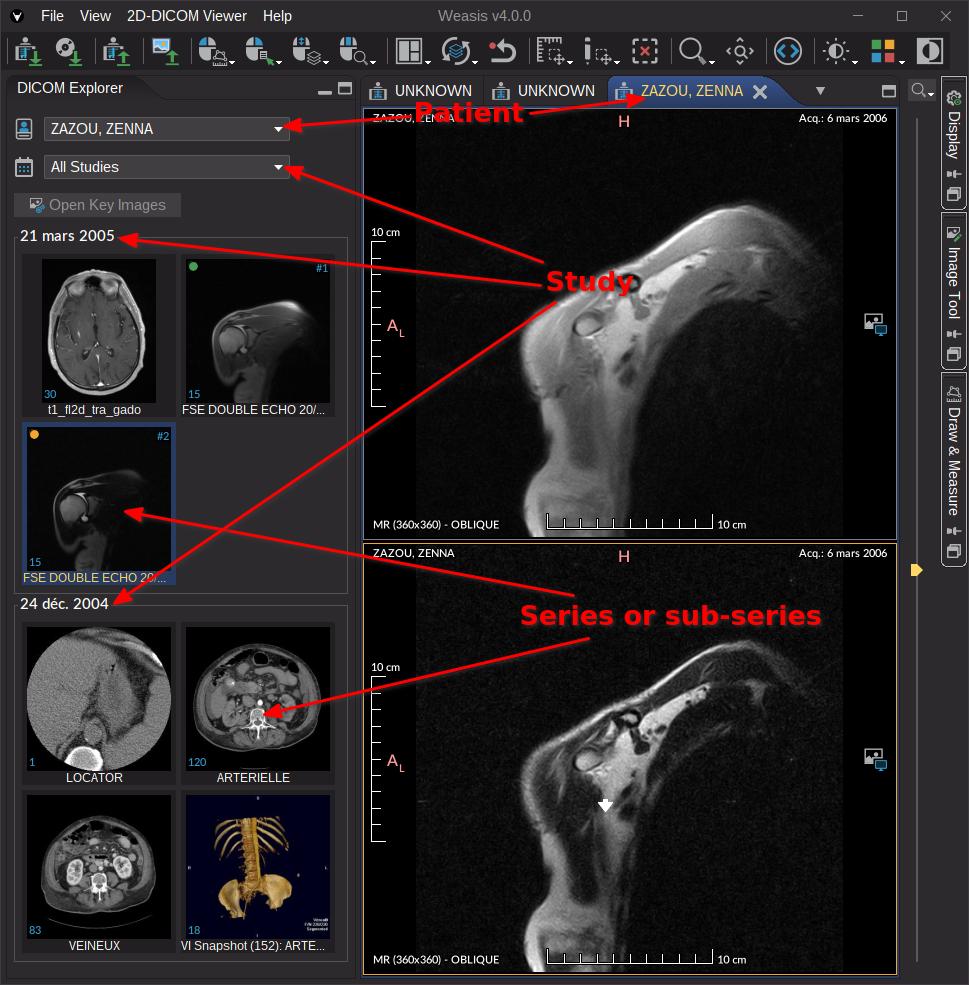 DICOM Explorer :: Weasis Documentation DICOM Explorer :: Weasis Documentation