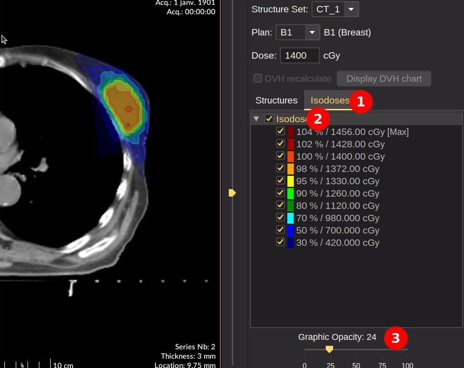 DICOM RT Tools :: Weasis Documentation DICOM RT Tools :: Weasis Documentation