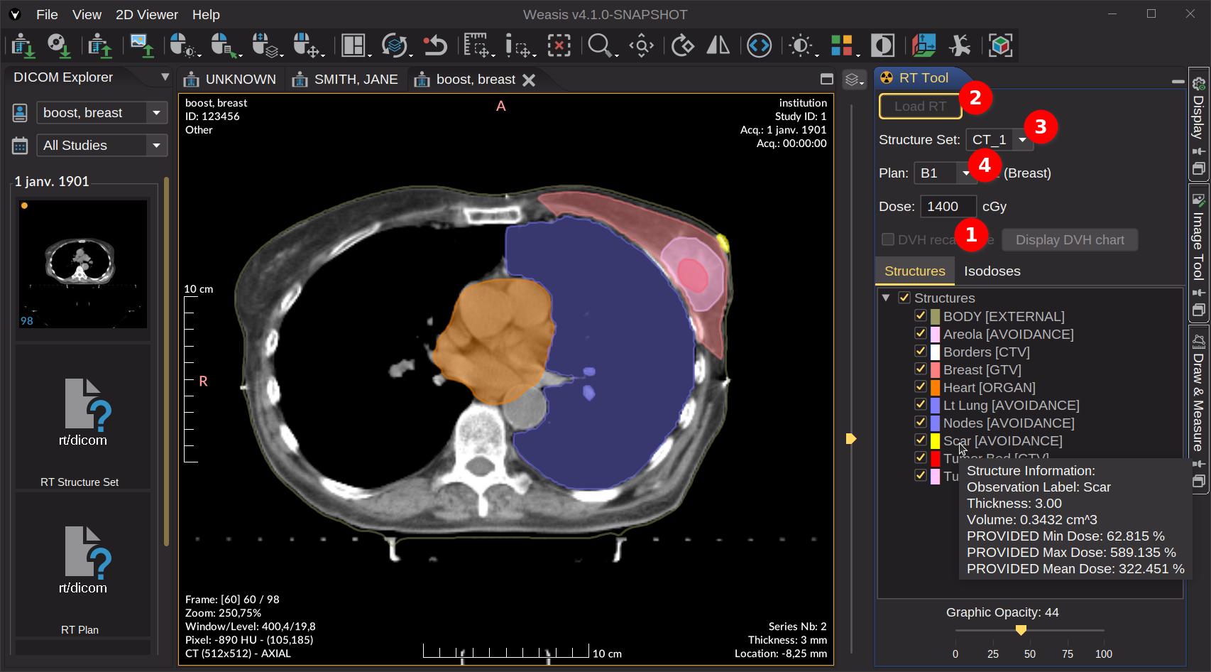 DICOM RT Tools :: Weasis Documentation DICOM RT Tools :: Weasis Documentation