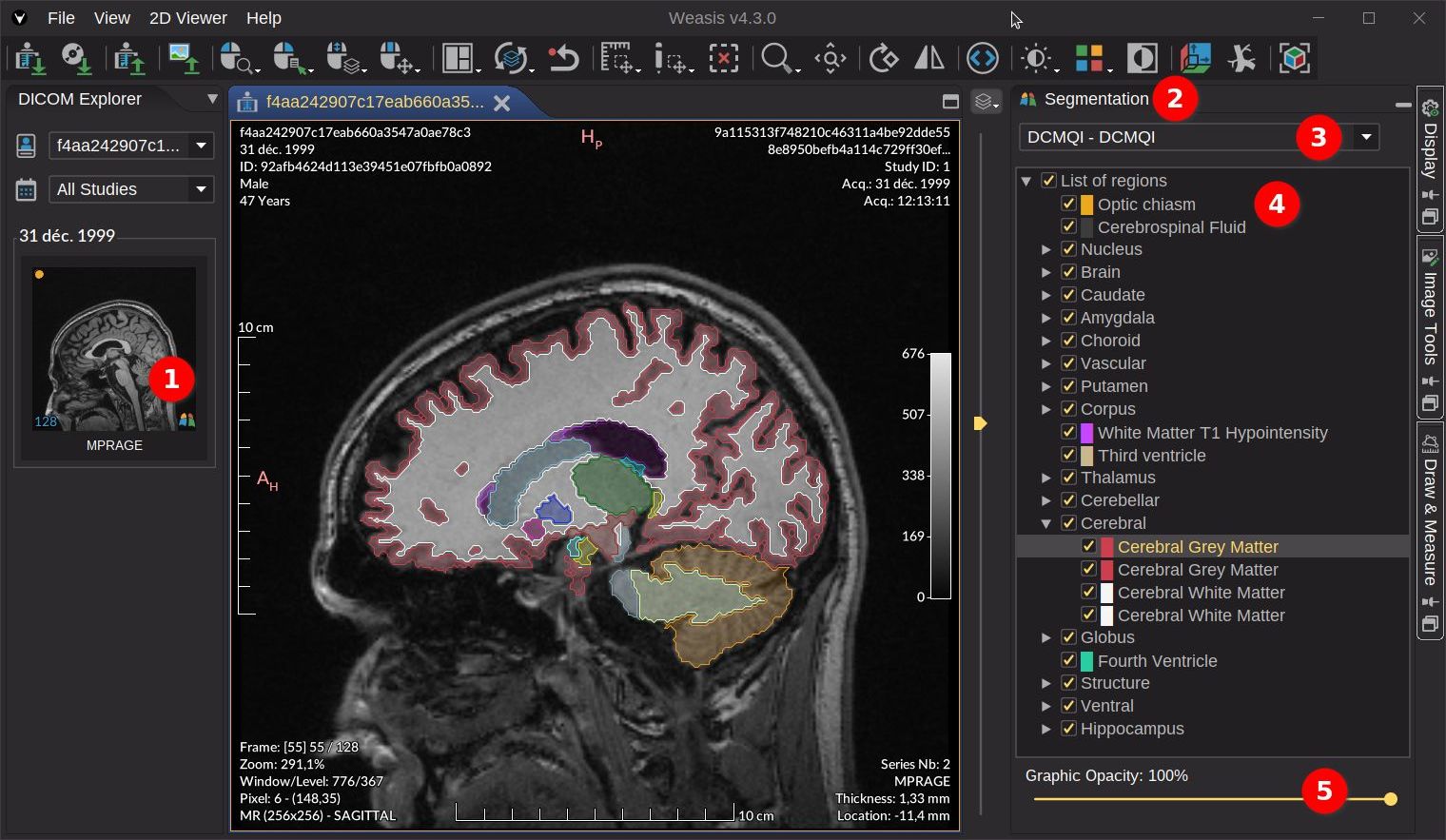 DICOM SEG :: Weasis Documentation DICOM SEG :: Weasis Documentation