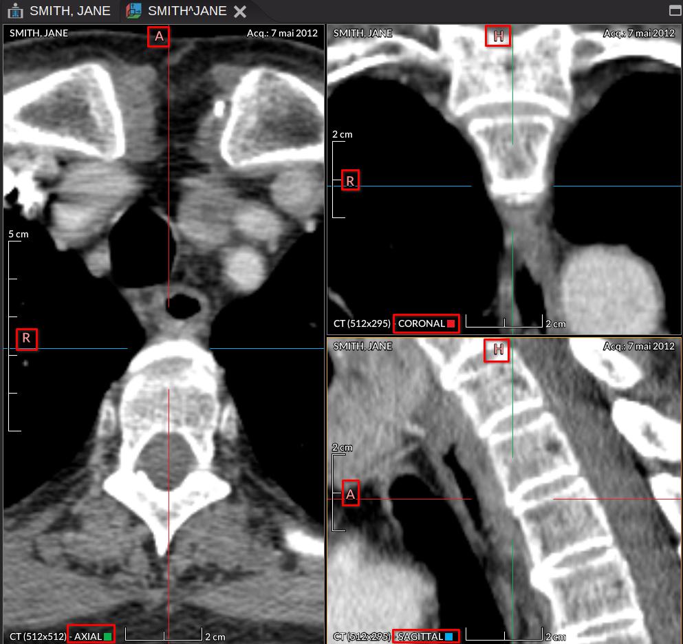 Image orientation :: Weasis Documentation Image orientation :: Weasis Documentation