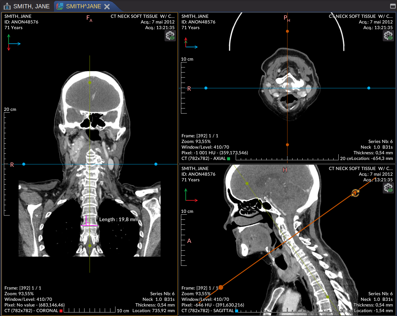 MPR Viewer :: Weasis Documentation MPR Viewer :: Weasis Documentation